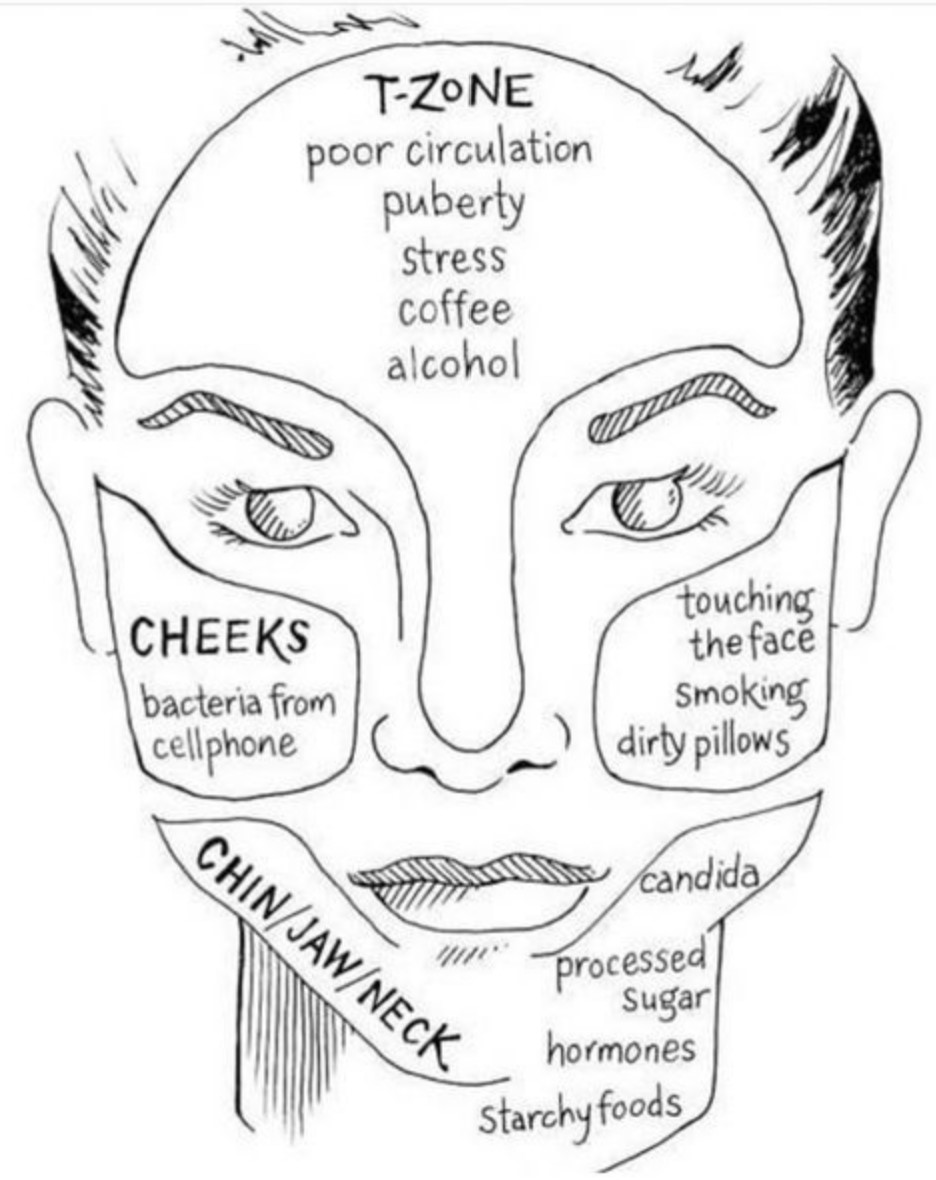 Breaking Down What’s Behind Your Breakouts - MUMbox